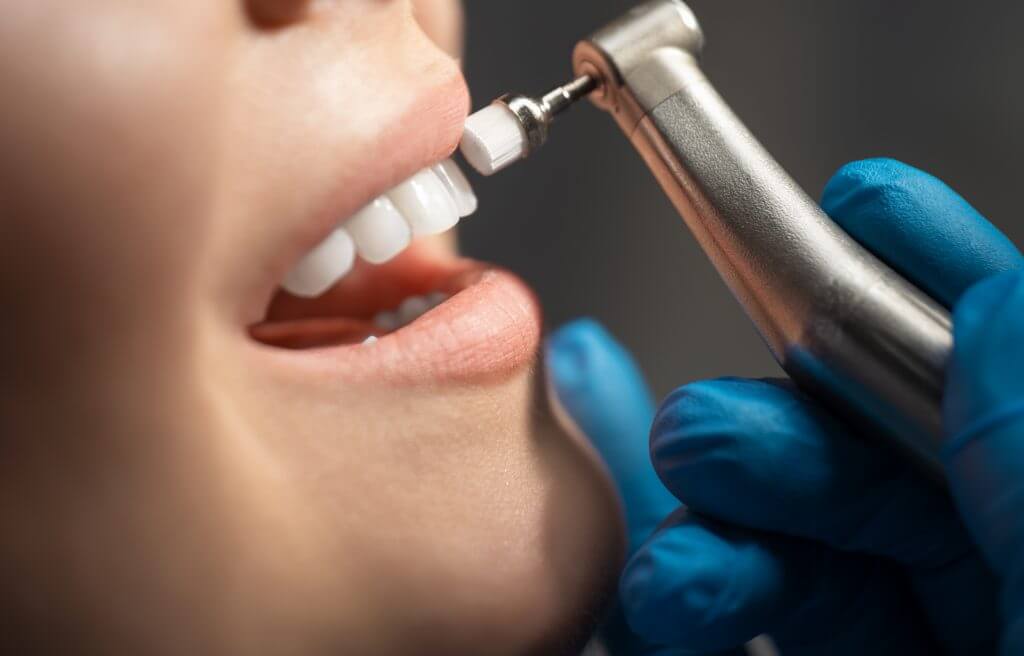 Deep Teeth Cleanings - Hale Family Dentistry